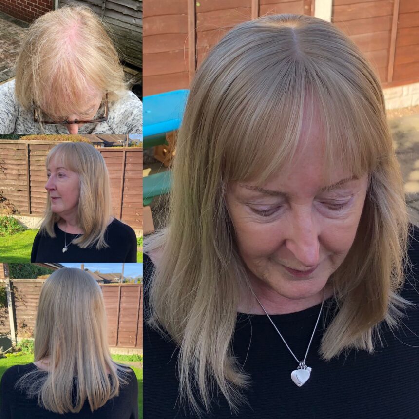 Gallery - Perfect Fringe