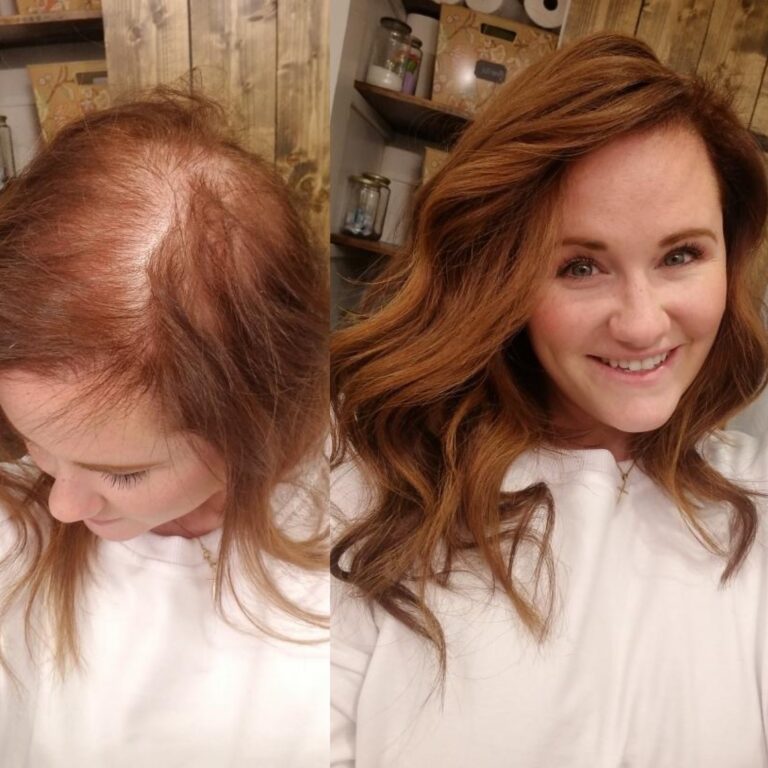 Gallery - Perfect Fringe