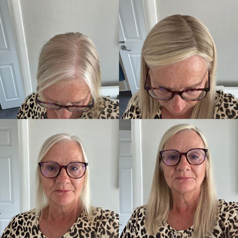 Gallery - Perfect Fringe